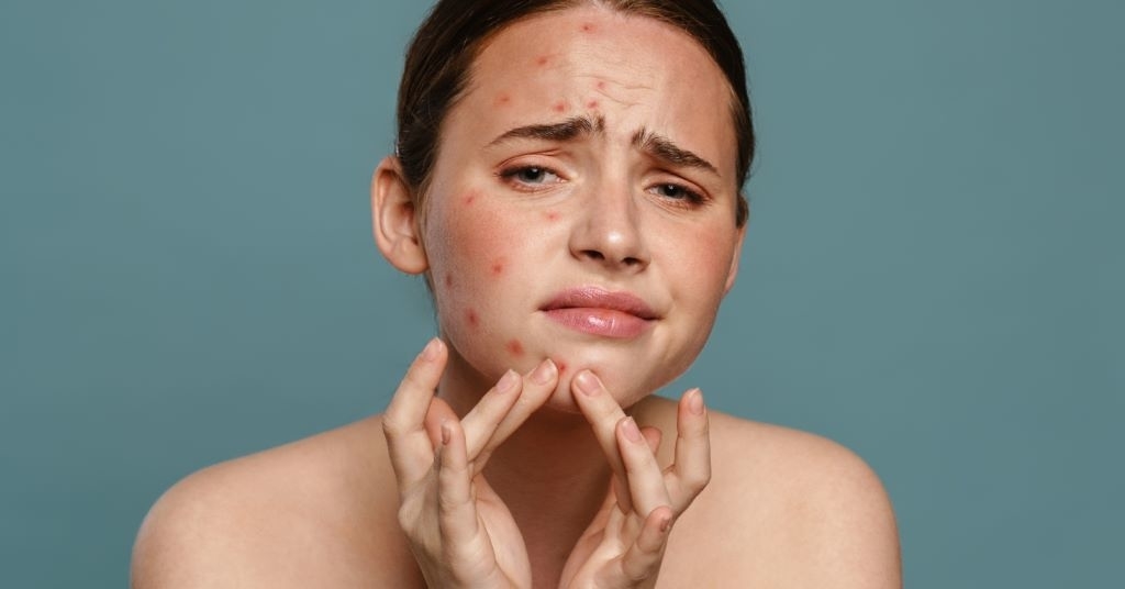 Common Skin Conditions: Types, Causes, Symptoms, Treatments, and More